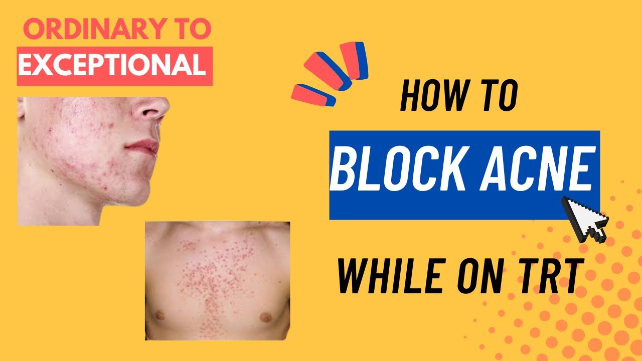 How To Block Acne While On TRT - YouTube
