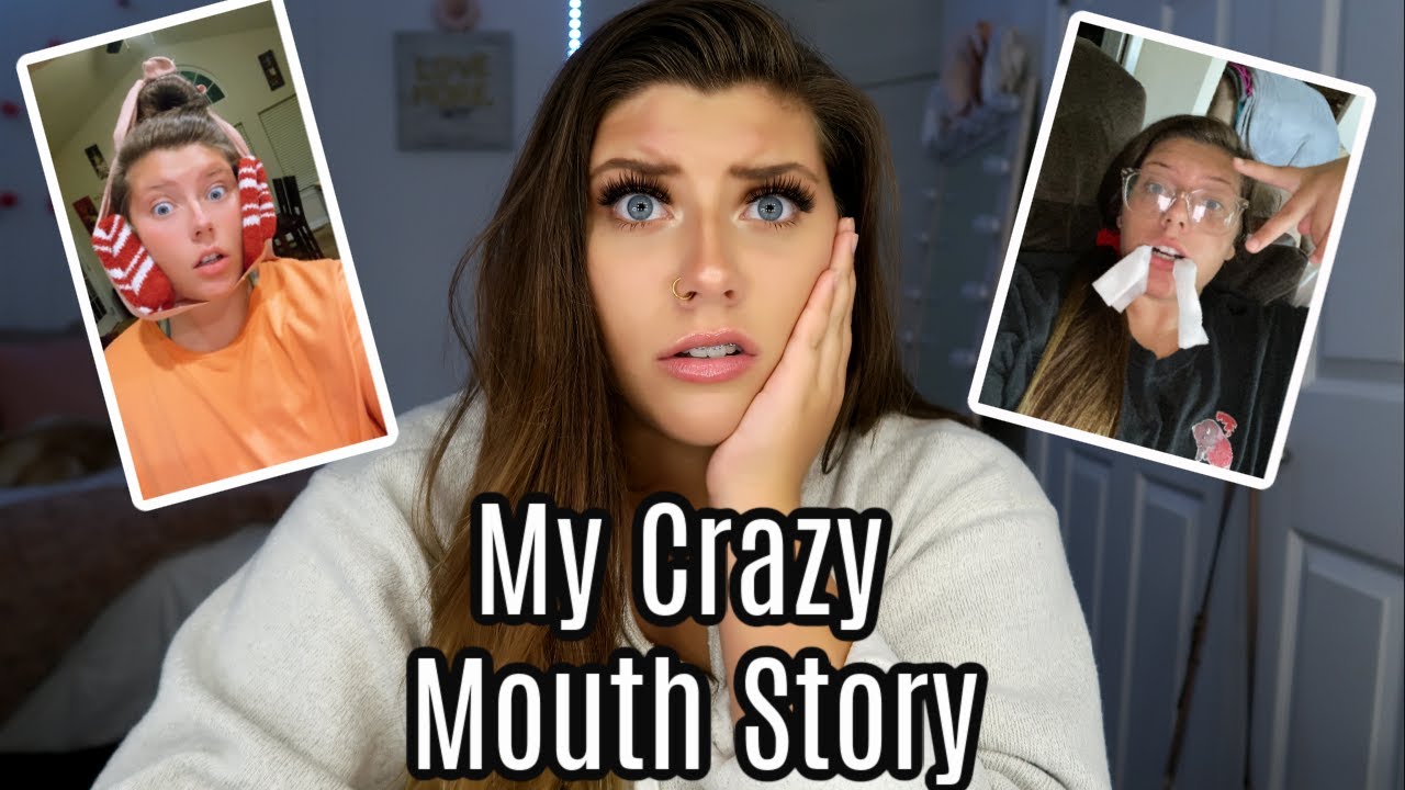 My Crazy Mouth Story / Wisdom Teeth & Braces!!!! - YouTube