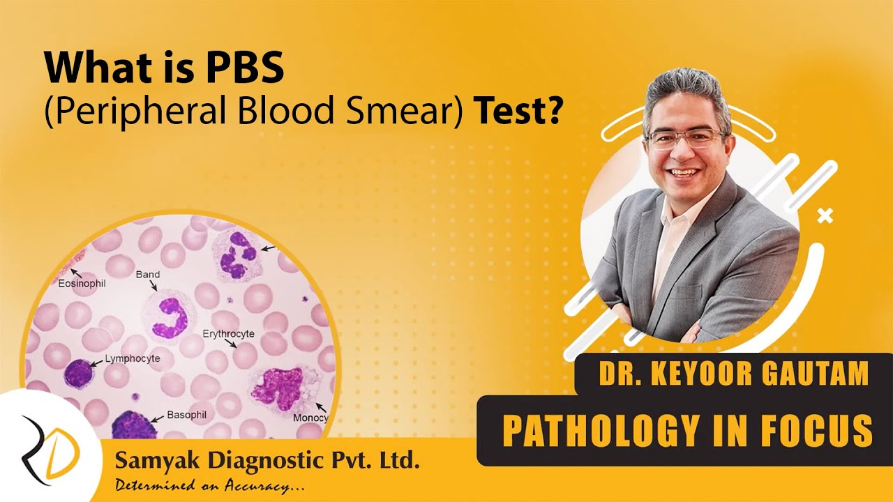 Episode 80 | What is PBS (Peripheral Blood Smear) Test? - YouTube