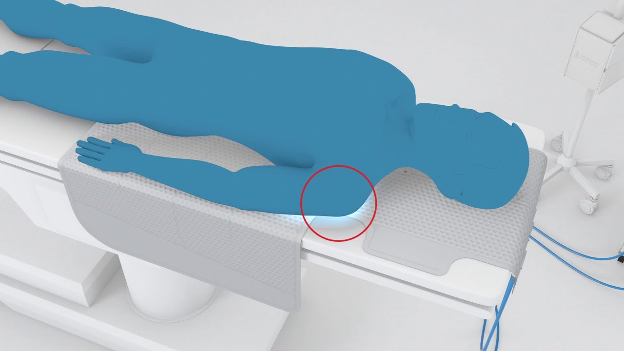 4. Patient Warming with Allon®: Getting Started - YouTube