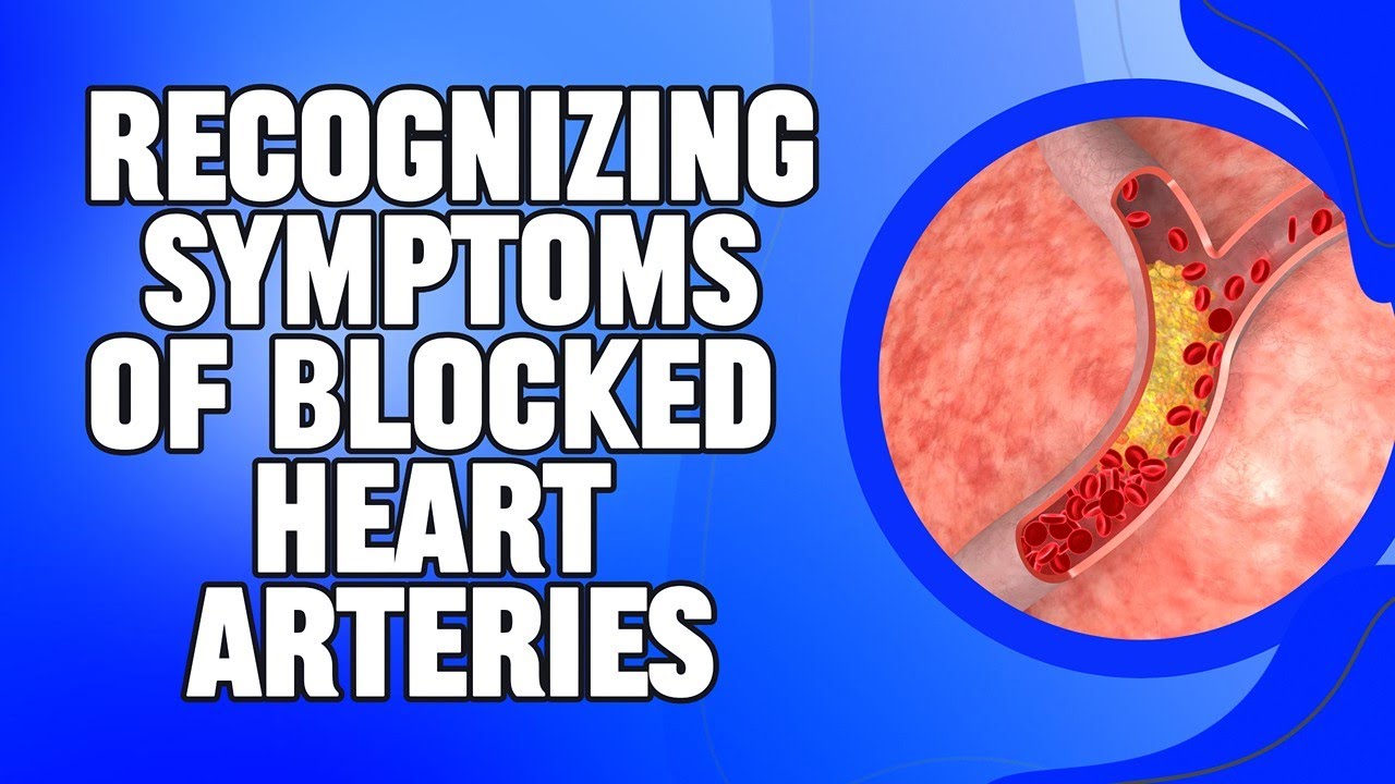 Recognizing Symptoms of Blocked Heart Arteries - YouTube