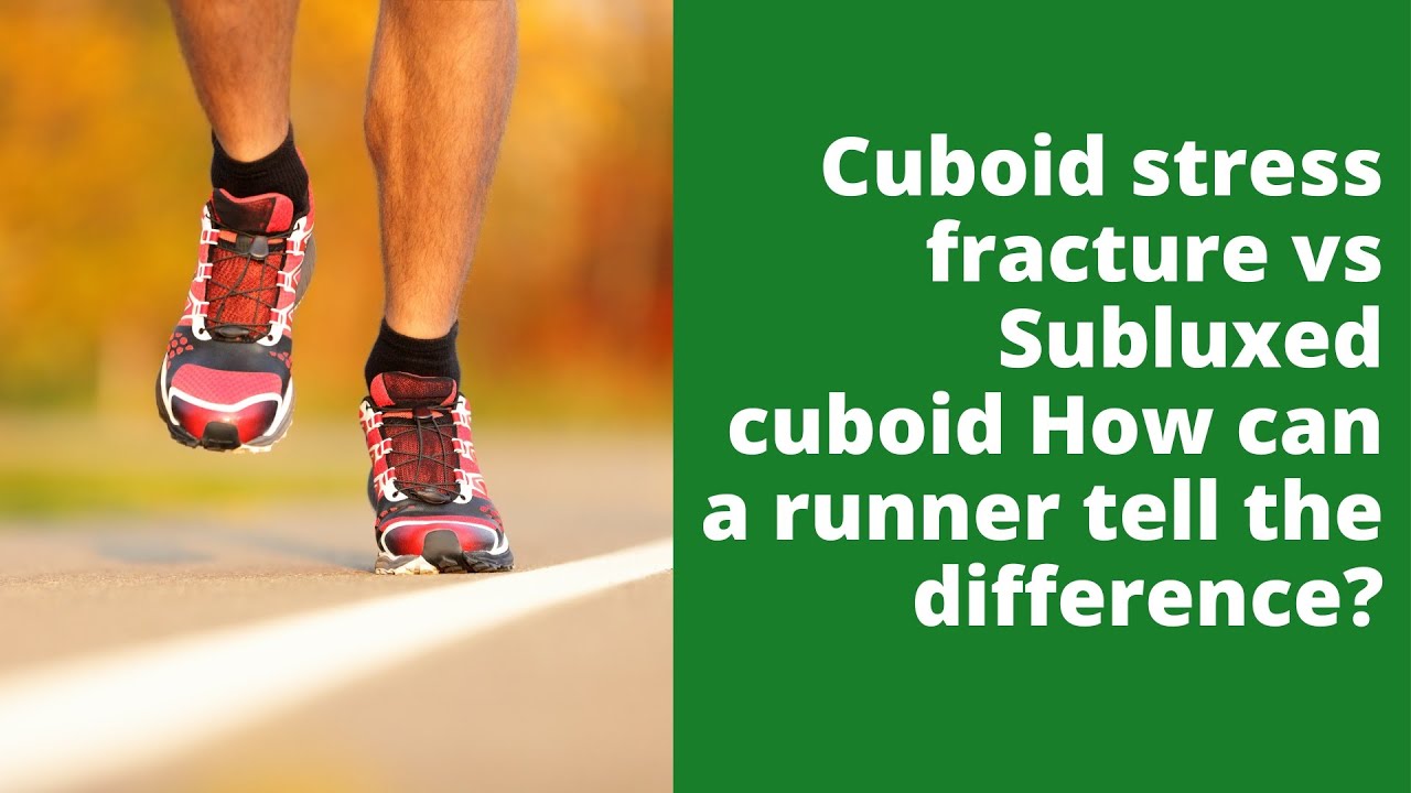 Cuboid stress fracture vs Subluxed cuboid How can a runner tell the ...