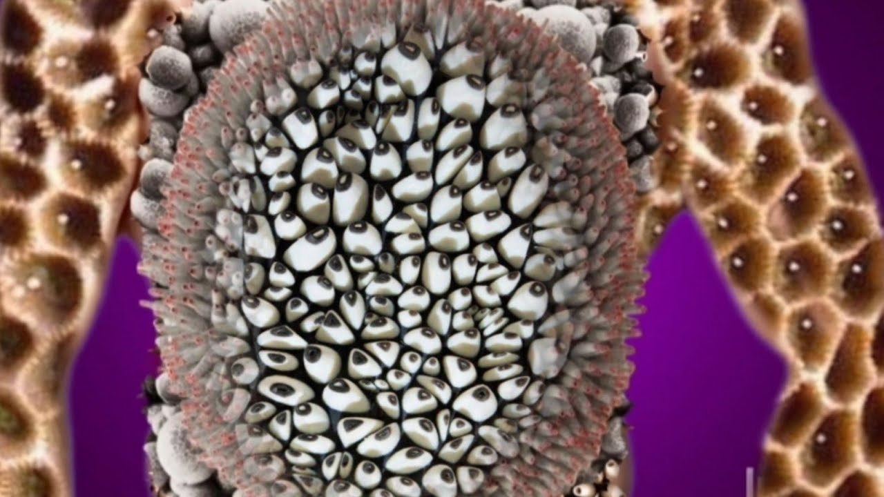 ASMR Animation Treatment Infected Chest,, treatment chest collection 🤧 ...