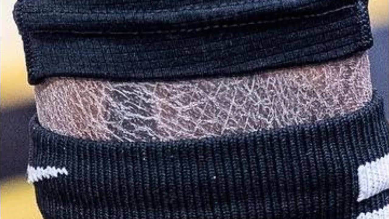 Ashy Ankles