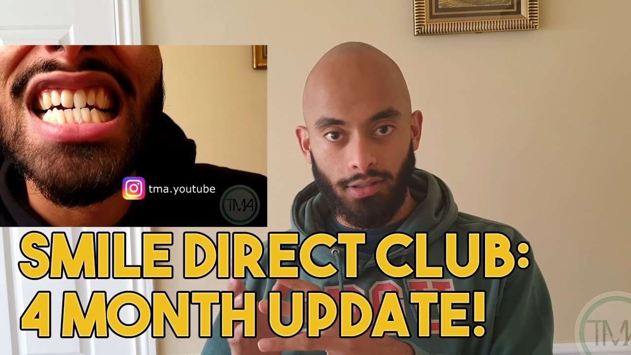 SMILE DIRECT CLUB: DOES IT WORK? 4 MONTH UPDATE! - YouTube