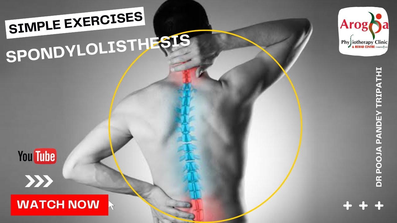 12 best Lumbar spondylolisthesis exercises and streches | Arogya ...