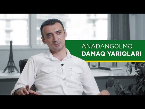 Anadangəlmə damaq yarıqları. \