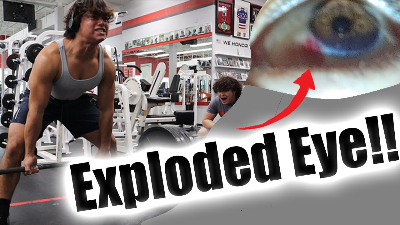 MAXING SUMO= EXPLODED EYE!!! - YouTube