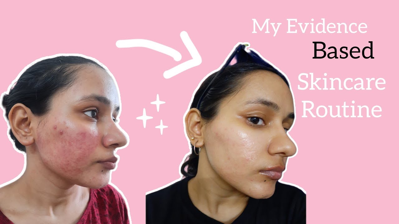 *MINIMAL* Skincare Routine which Changed my Skin | Evidence based ...