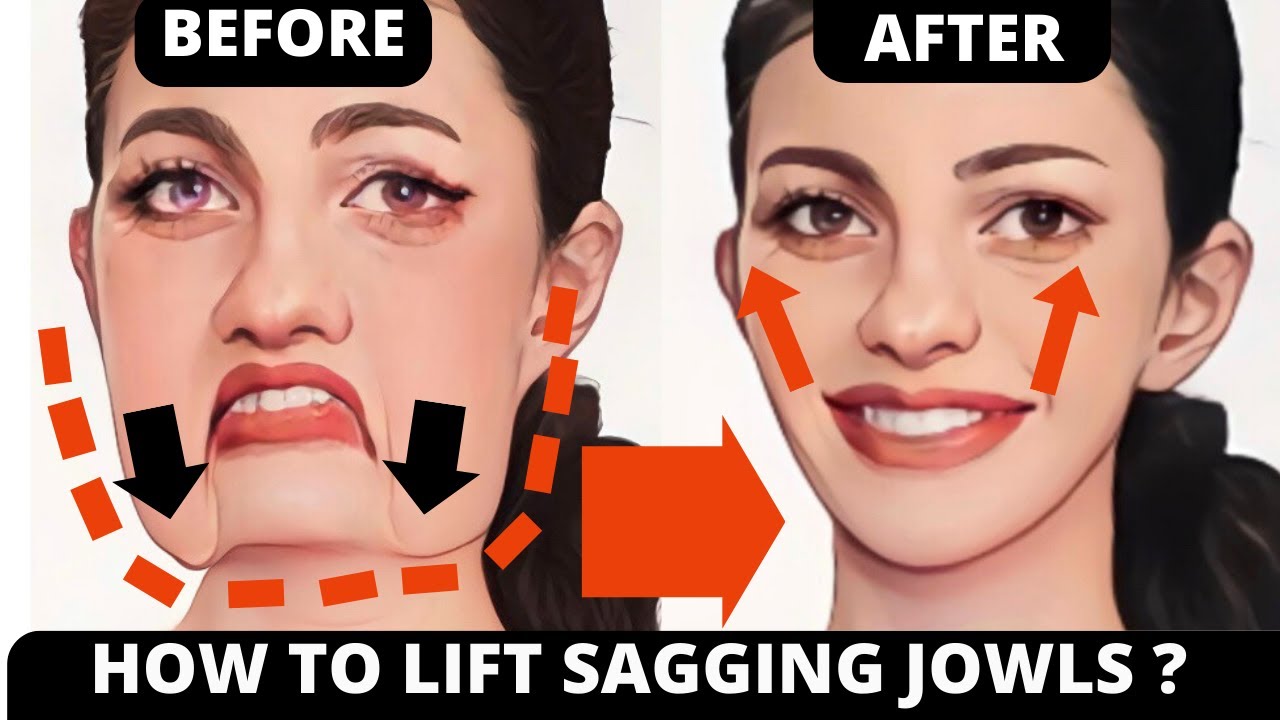 11-Min Face Lift! 💆‍♀️ Tighten Jowls, Cheeks & Double Chin Naturally ...