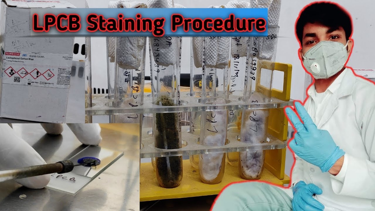 LBCP Staining Procedure | Fungus Under microscope | Lactophenol Cotton ...