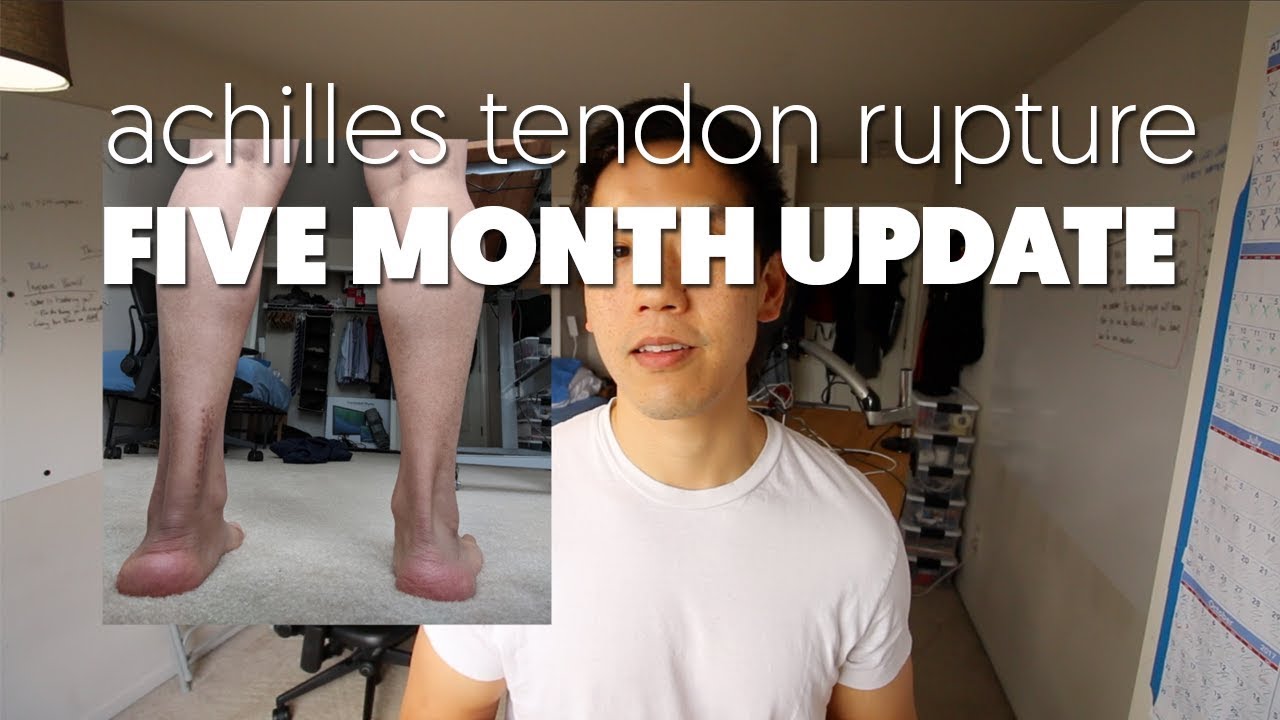 achilles-tendon-rupture-five-month-post-op-update-youtube
