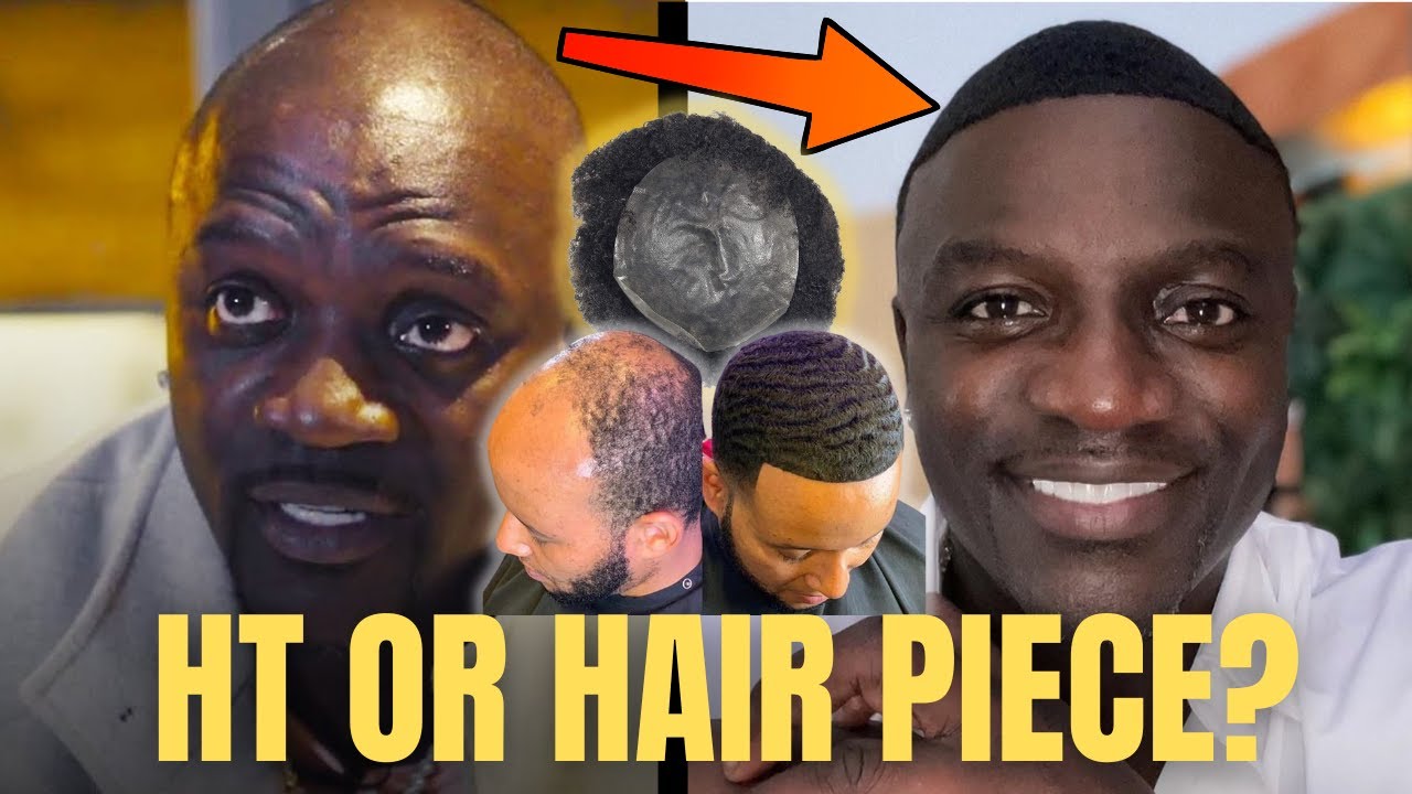 Did Akon Get a Hair Transplant or is it a Hair Piece? - YouTube