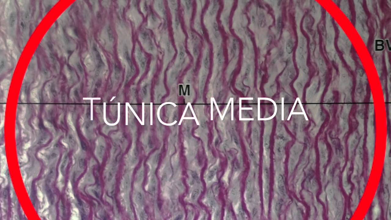 MICROFOTOGRAFÍA DE LA AORTA - YouTube