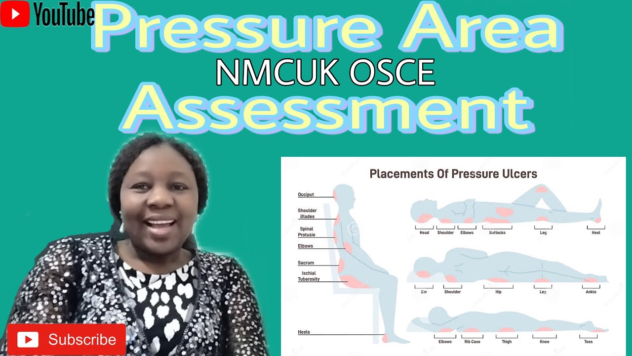 Pressure Area Assessment made simple - YouTube