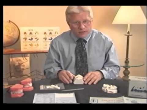 2 MARA ORTHODONTIC OVERBITE CLASS II BRACES CORRECTOR HOW TO GET IT ...