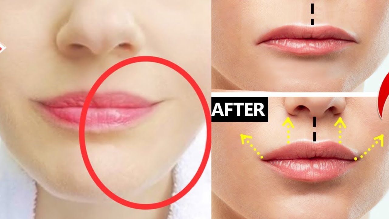 Lip & Cheek Lift Exercise To Fix Long PHILTRUM! Shorten PHILTRUM, Long ...