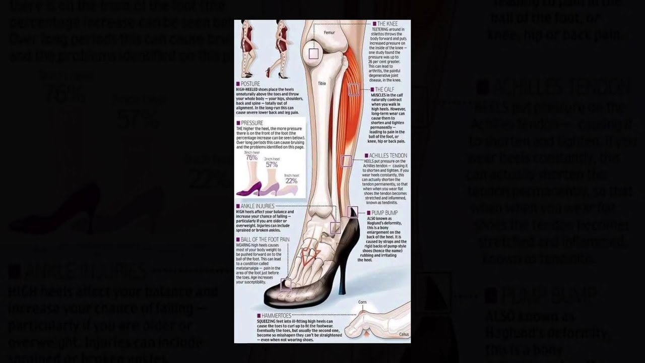 Side effects of high heels - YouTube