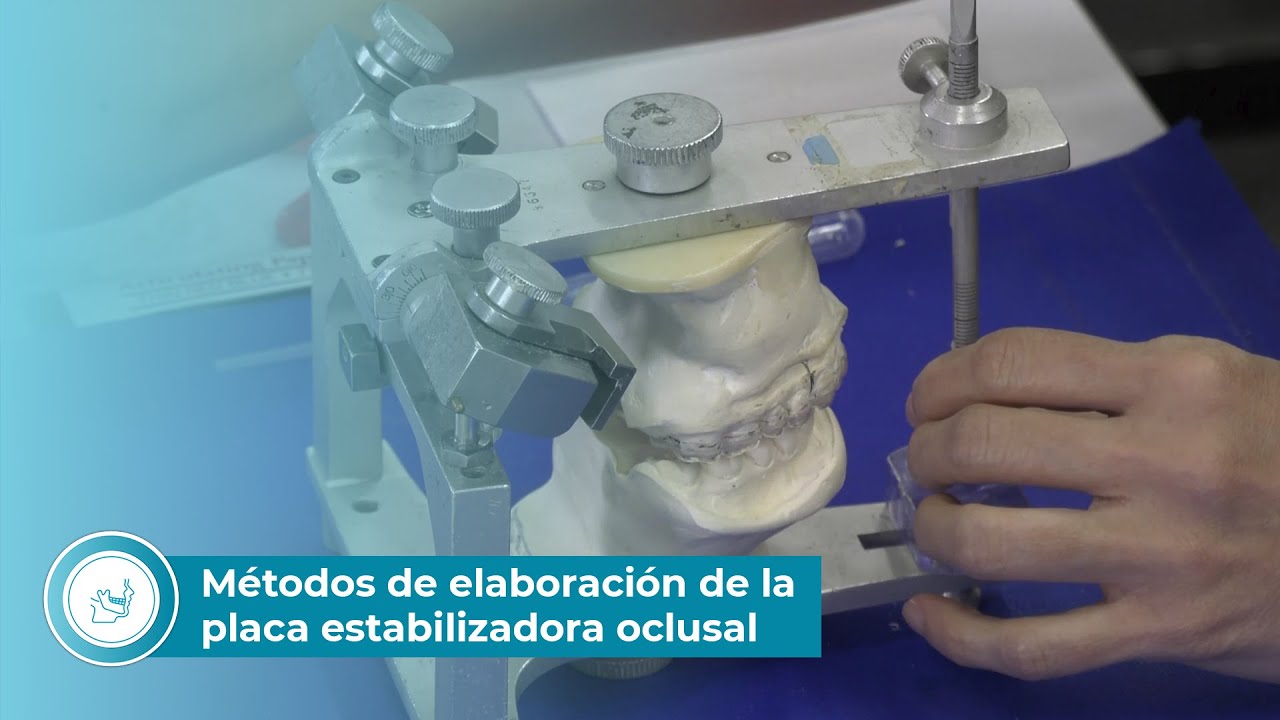 Métodos de elaboración de la placa estabilizadora oclusal - YouTube