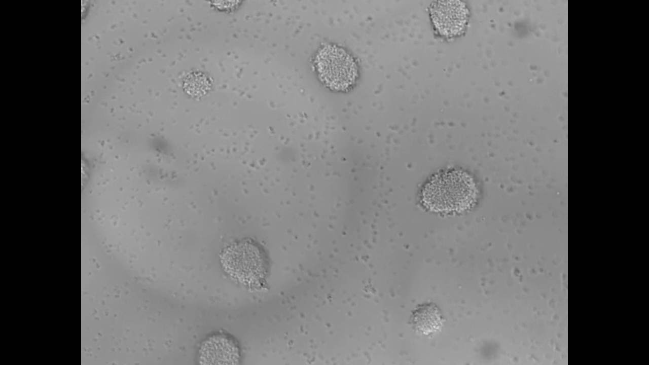 Microcolony formation of bacteria over 7 hours - YouTube
