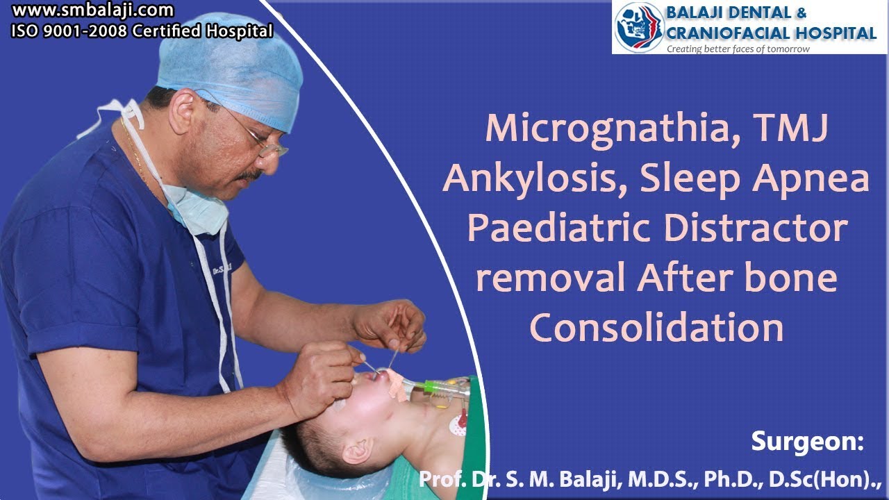 Micrognathia, TMJ Ankylosis, Sleep Apnea, Pediatric Distractor Removal ...