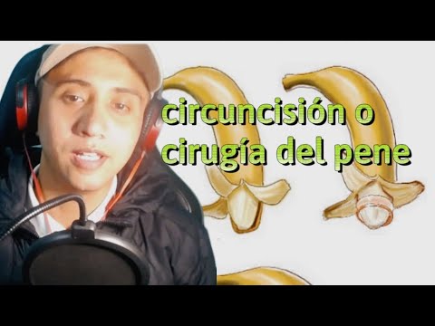 Circuncisión o cirugía en el pene, miembro. Retirada de prepucio ...