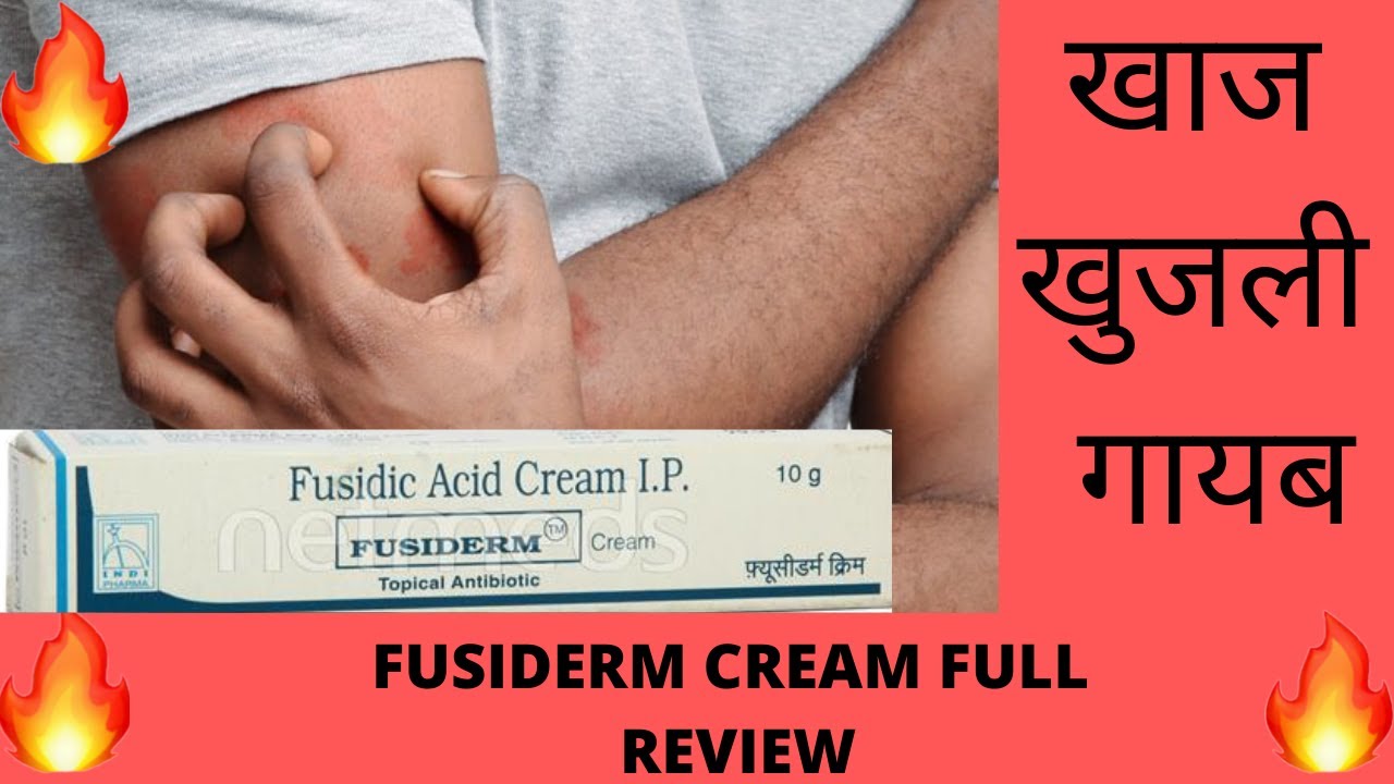 FUSIDERM Cream Full review Best cream for itching & Irritation , क्या ...