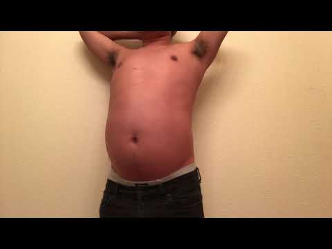 Guy post-buffet stuffing bloat
