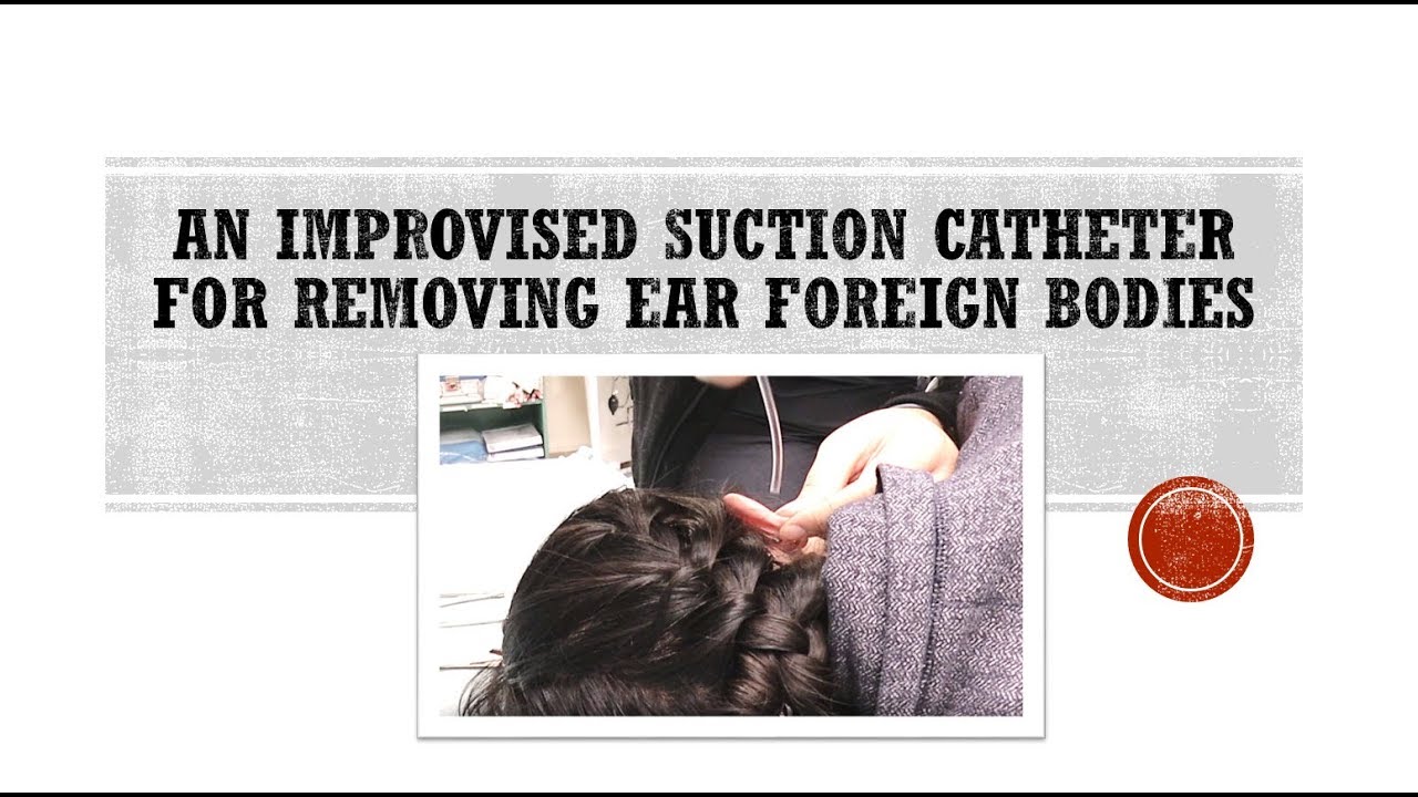 An Improvised Suction Catheter for Removing Ear Foreign Bodies - YouTube