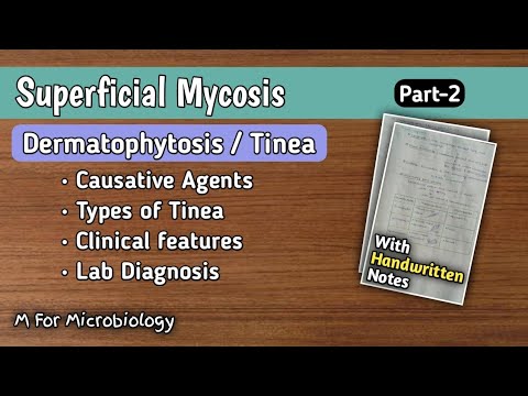 Dermatophytosis | Causative agent | Types of Tinea | Clinical Feature ...