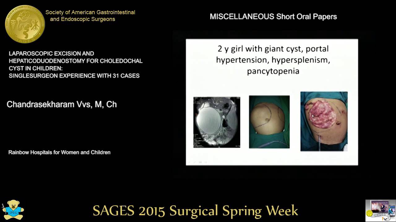 LAPROSCOPIC EXCISION AND HEPATICODUODENOSTOMY FOR CHOLEDOCHAL CYST IN ...