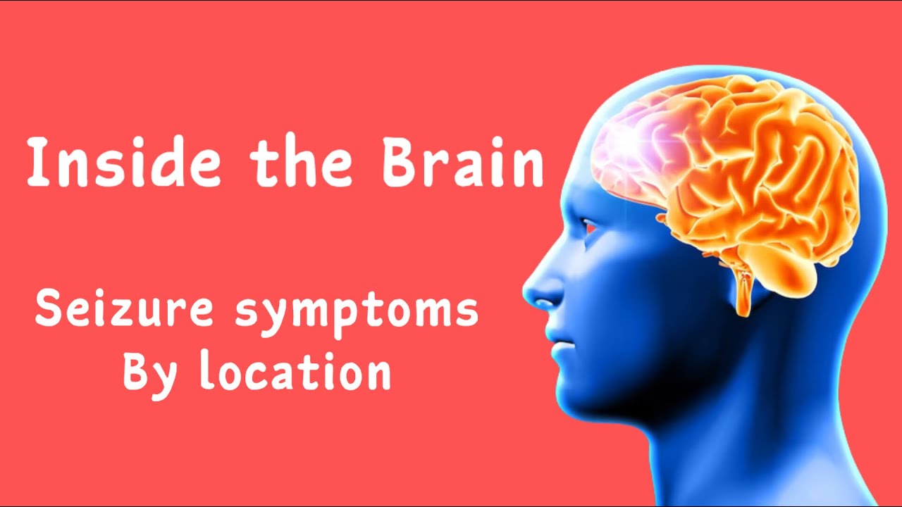 Inside the Brain: Seizure Symptoms Explained by Location - YouTube