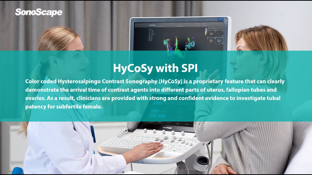 HyCoSy with SPI - YouTube