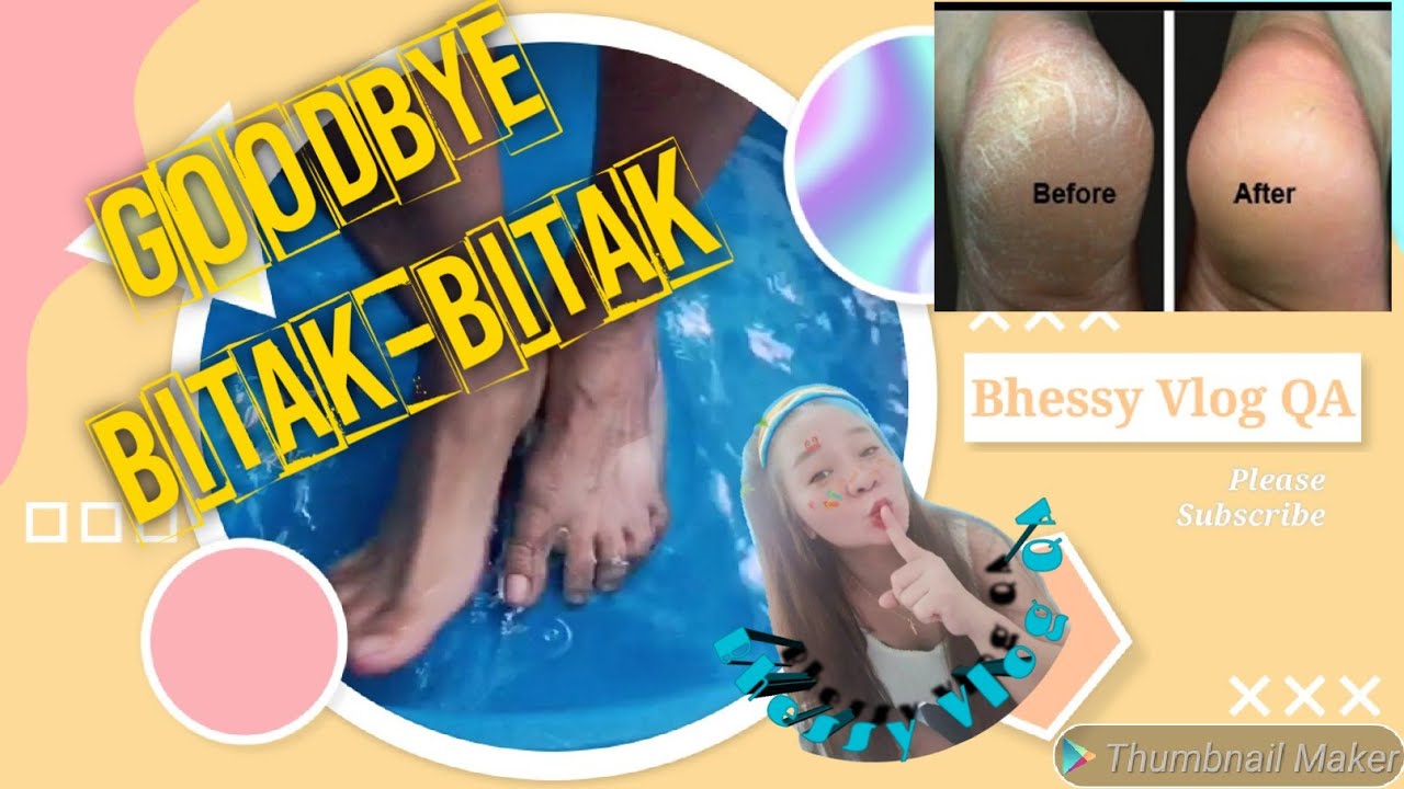 EASY SOLUSYON SA BITAK-BITAK NA PAA || CRACK HEEL - YouTube