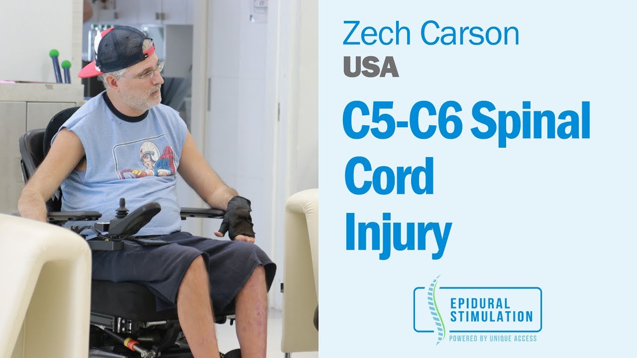 American C5-C6 Spinal Cord Injury Patient Zech Undergoes Epidural ...
