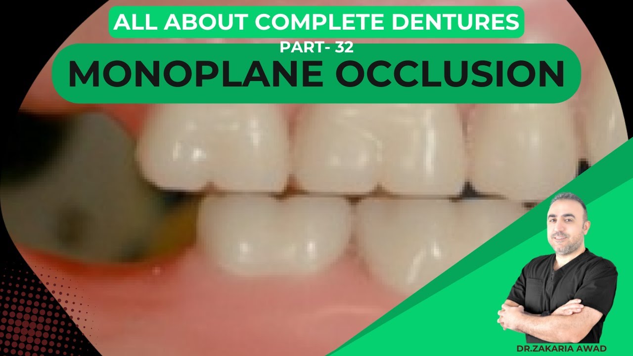 32- Monoplane Occlusion in Complete Dentures: A Simplified Guide (Part ...