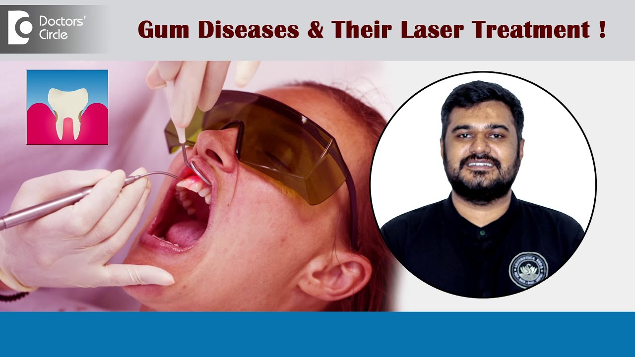 LASER Treatment for Bleeding Gums, Gum Diseases & Gum Pockets - Dr ...