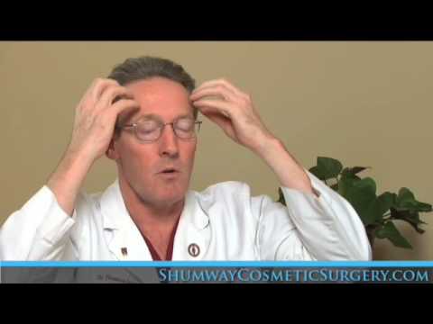 Facelift in La Jolla, San Diego, CA by Dr. Robert Shumway - YouTube