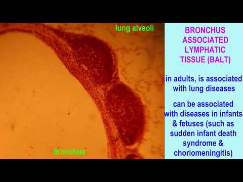 Bronchus-Associated Lymphoid Tissue (BALT) - YouTube