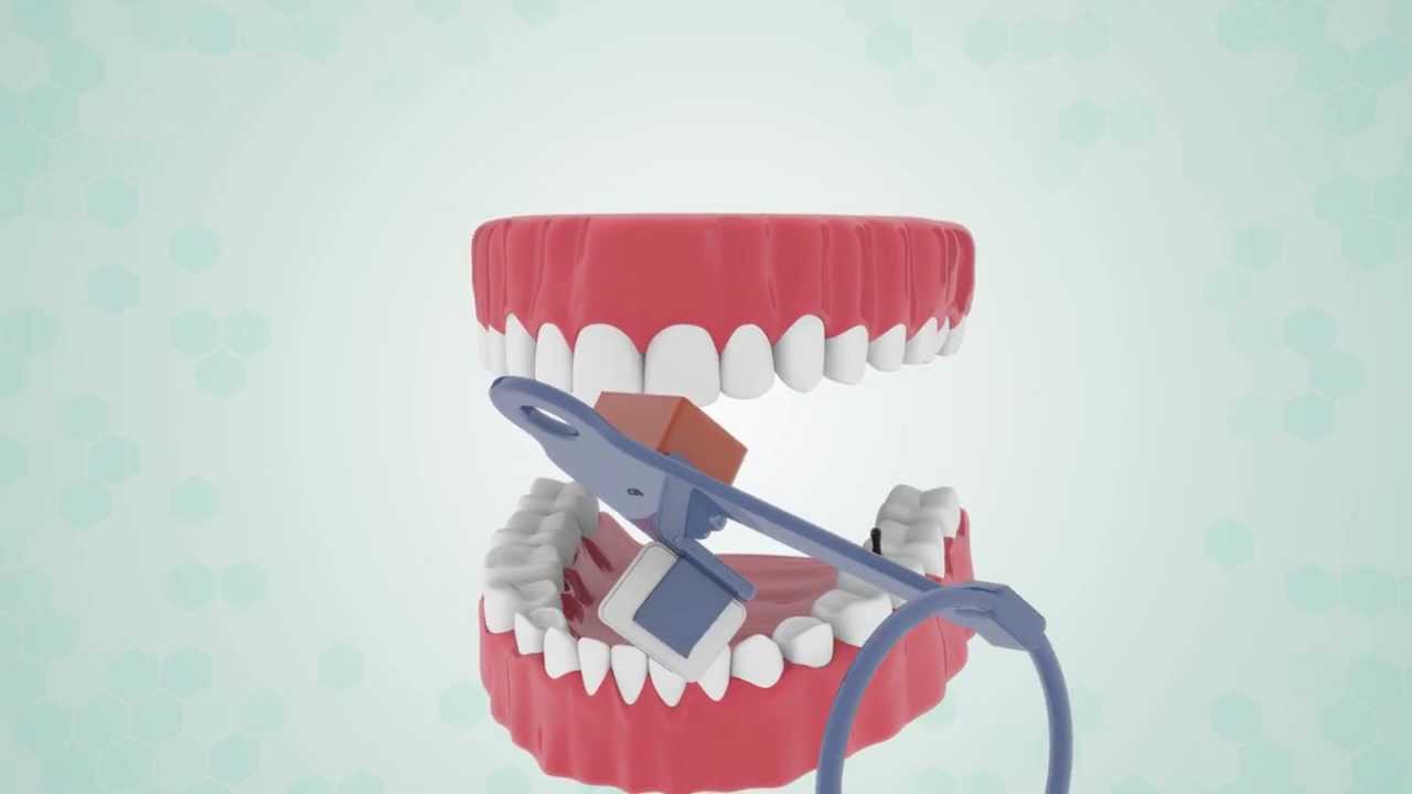 ENDO RH Plus - YouTube