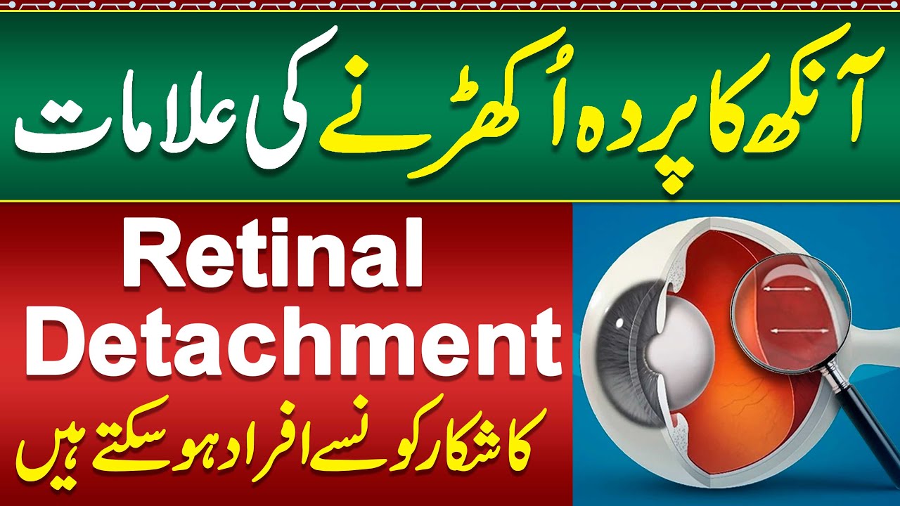 Retinal Detachment Kya Hai? - Retinal Detachment Causes and Treatment ...