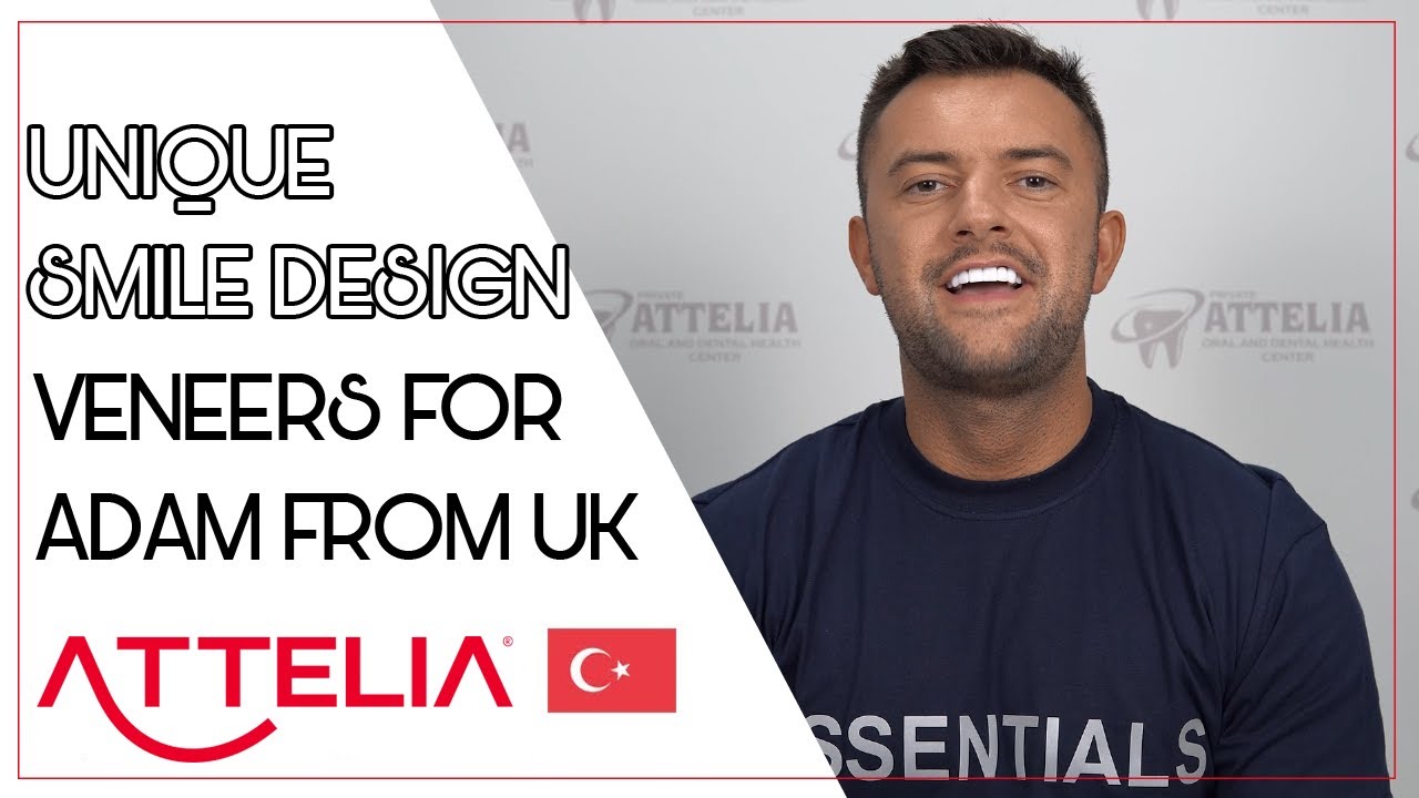 ADAM FROM UK UPGRADED HIS SMILE WITH ATTELIA - YouTube