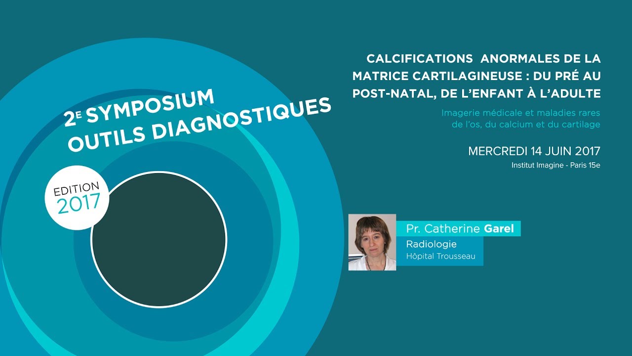 Calcifications anormales de la matrice cartilagineuse (Juin 2017) - YouTube