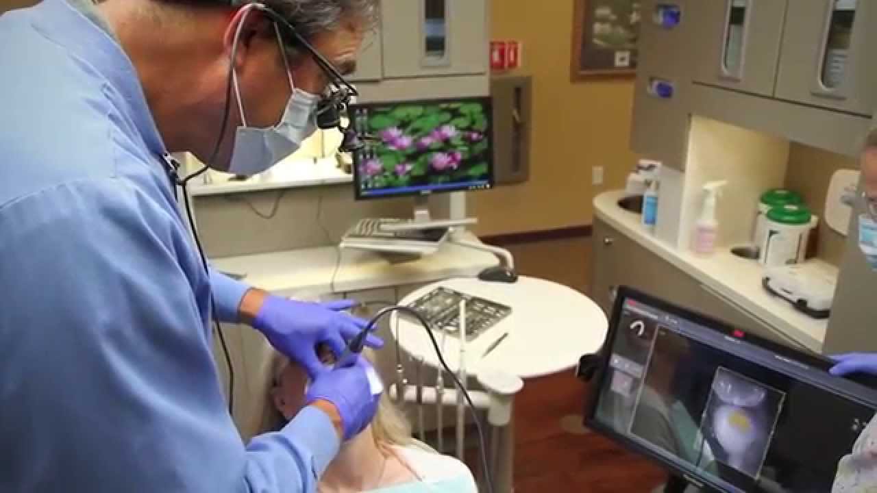 3M Dental Scanner - YouTube