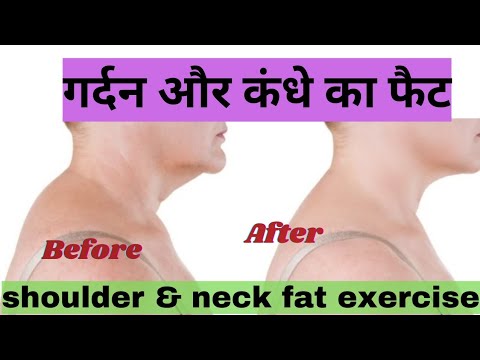 Lose Neck and Shoulder Fat। Neck and Shoulder फैट घटाएं 1 सप्ताह में ...