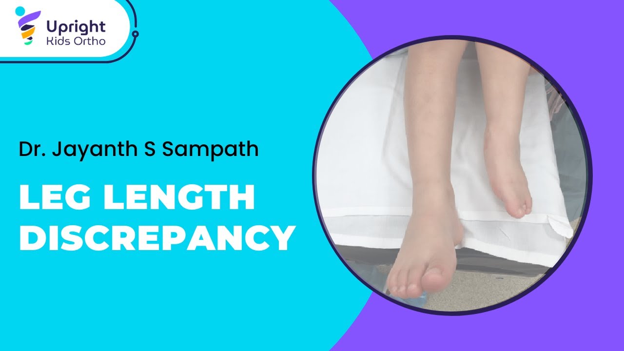 Leg Length Discrepancy| Best treatment for Leg Length Discrepancy in ...