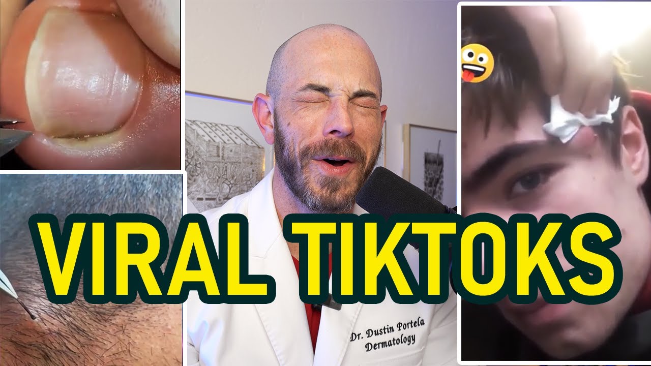 Dermatologist's Jaw-Dropping Reaction to Amazing Pimple Pops - YouTube