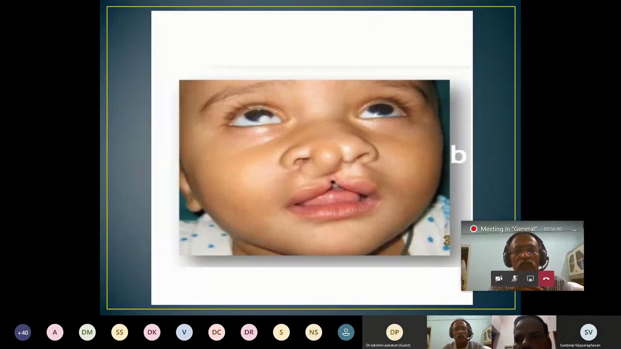 Plastiquest Case Discussion-Spotters(Goldenhar Syndrome and Tessier 7 ...