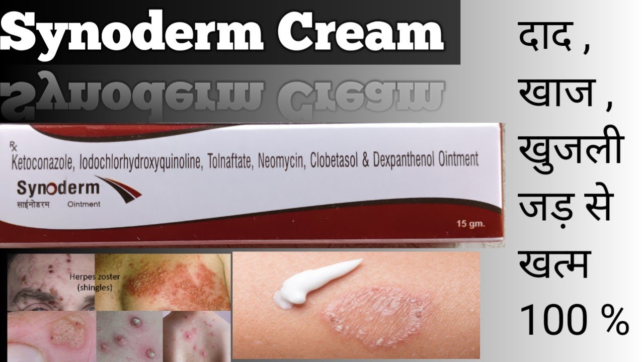 Synoderm Cream best uses for infection #Video - YouTube