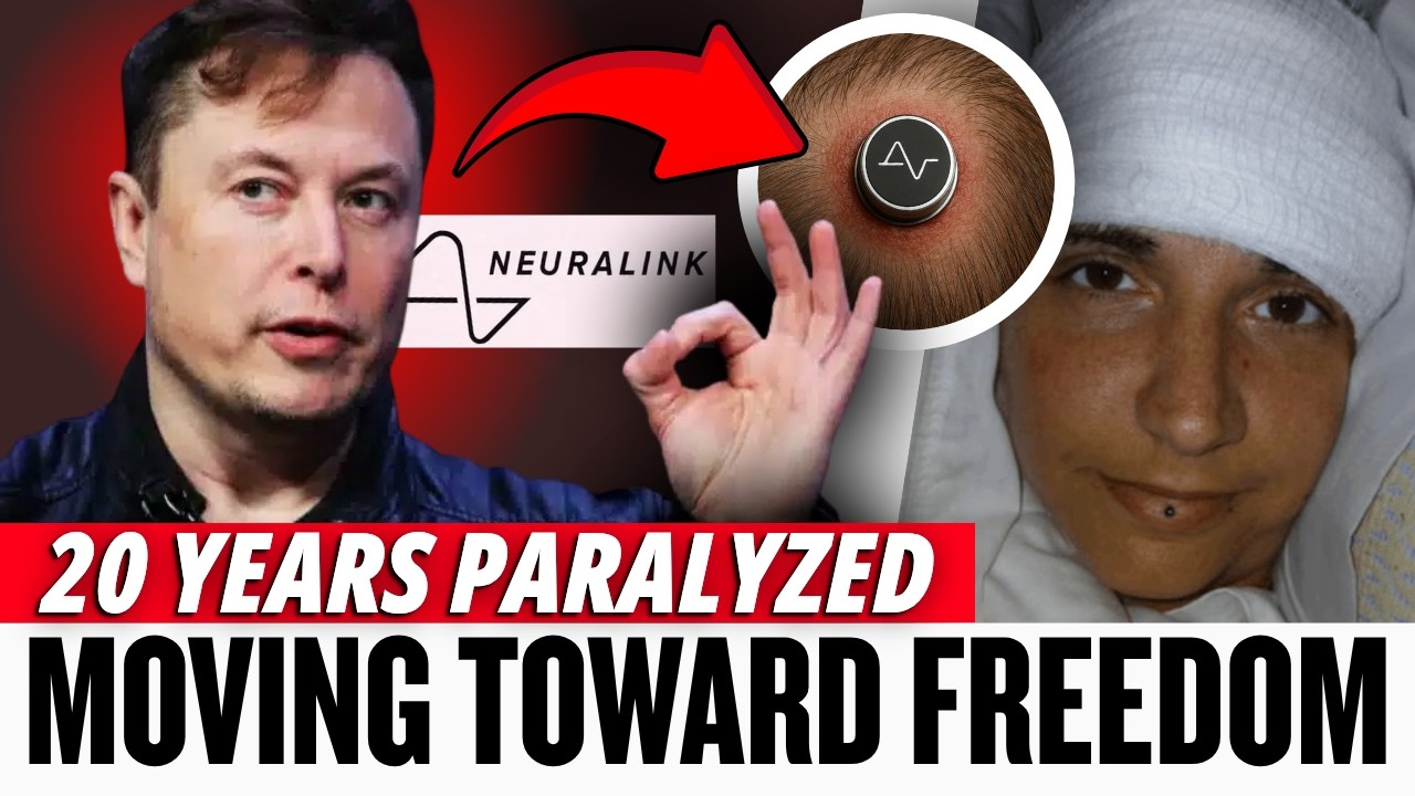 NEURALINK: Woman Paralyzed for 20 Years Uses TELEPATHY for the First ...